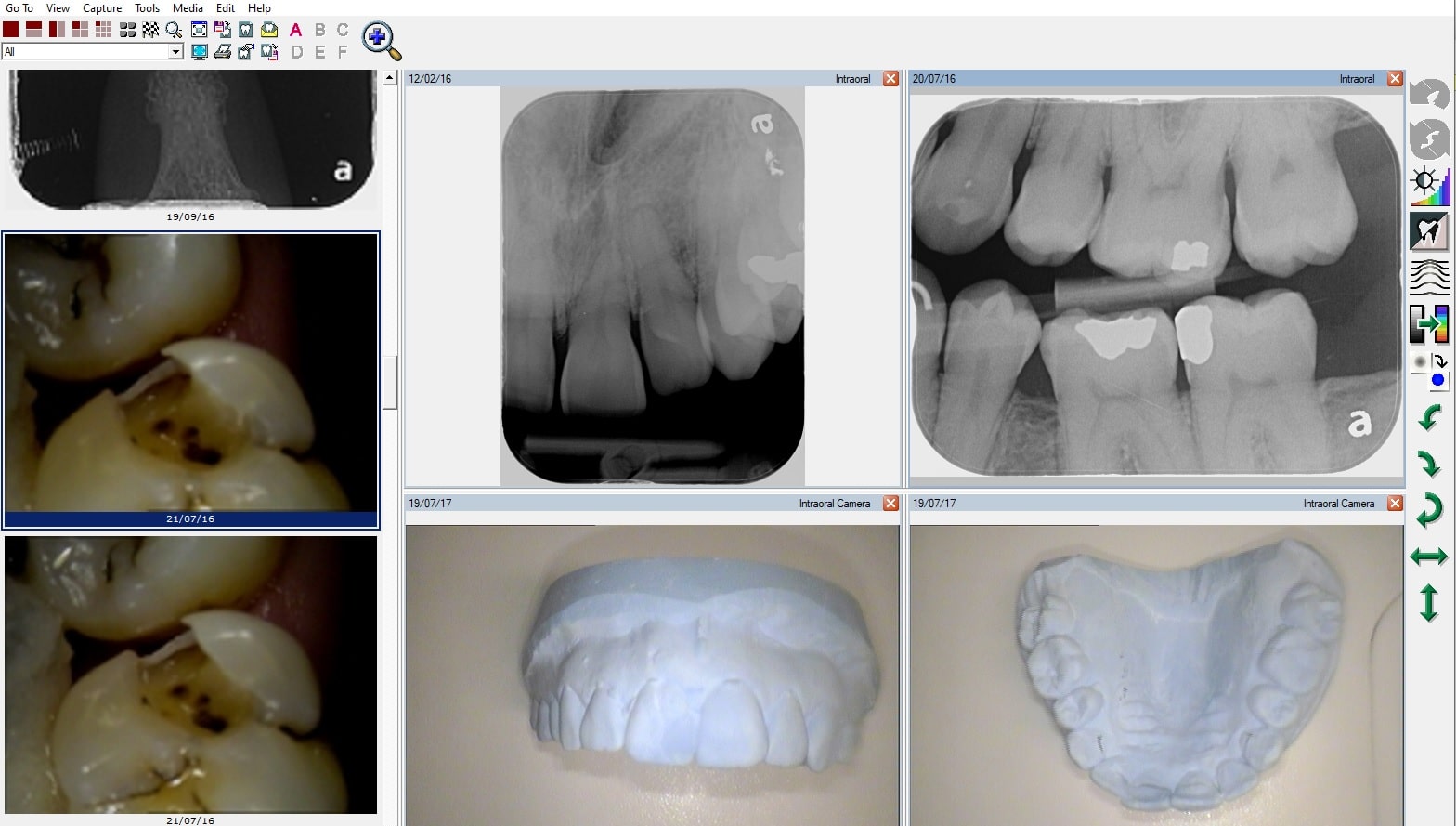 Dental Imaging Sydney - The Dentist at 70 Pitt Street