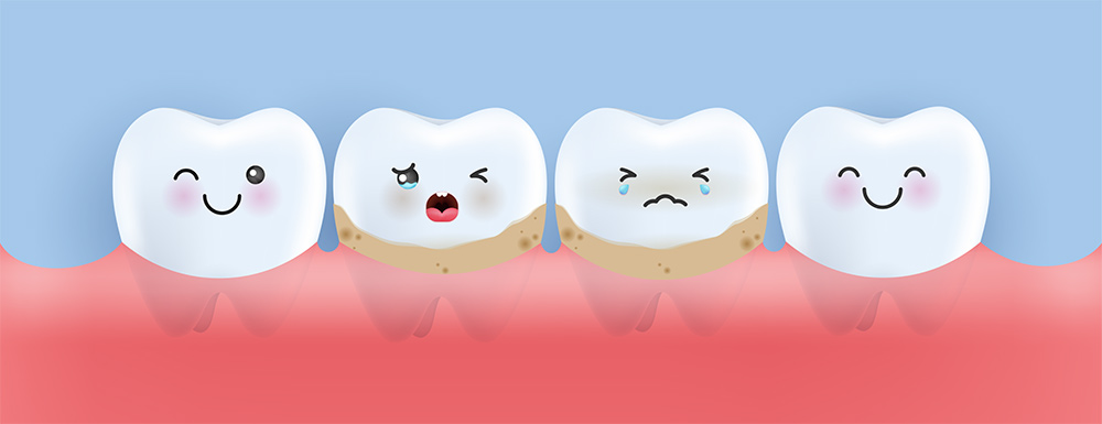 What Is Plaque on Teeth and Why It Matters for Your Smile